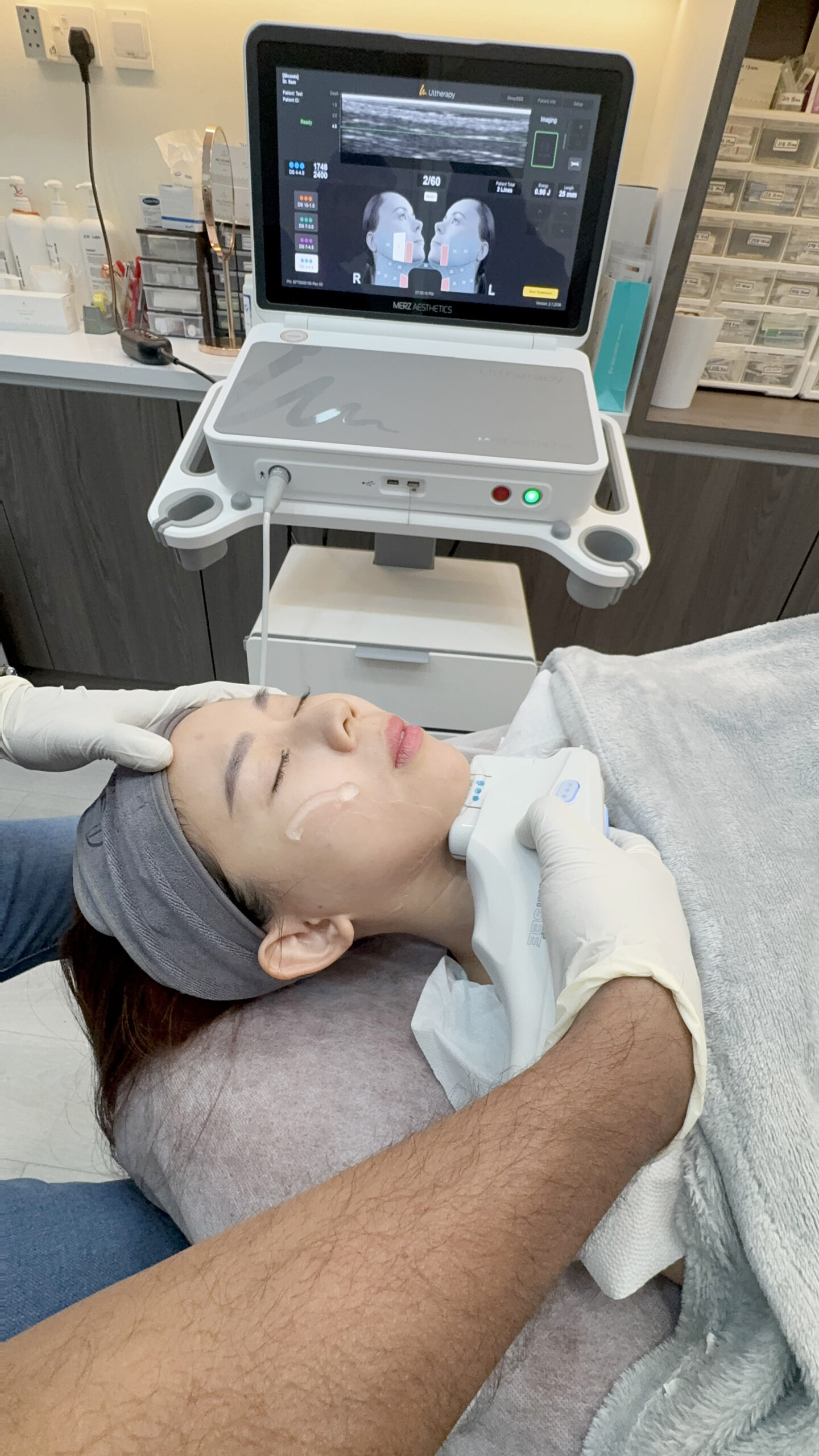 Microfocused Ultrasound | Skin Tightening Singapore